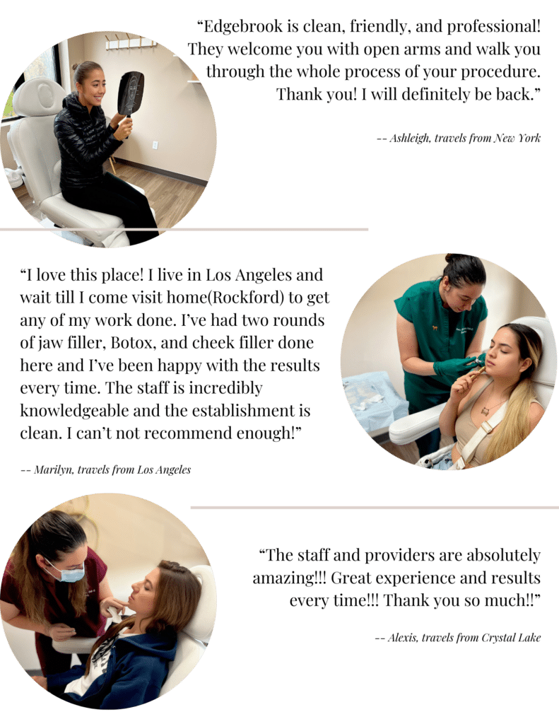 Fillers - Edgebrook Dermatology