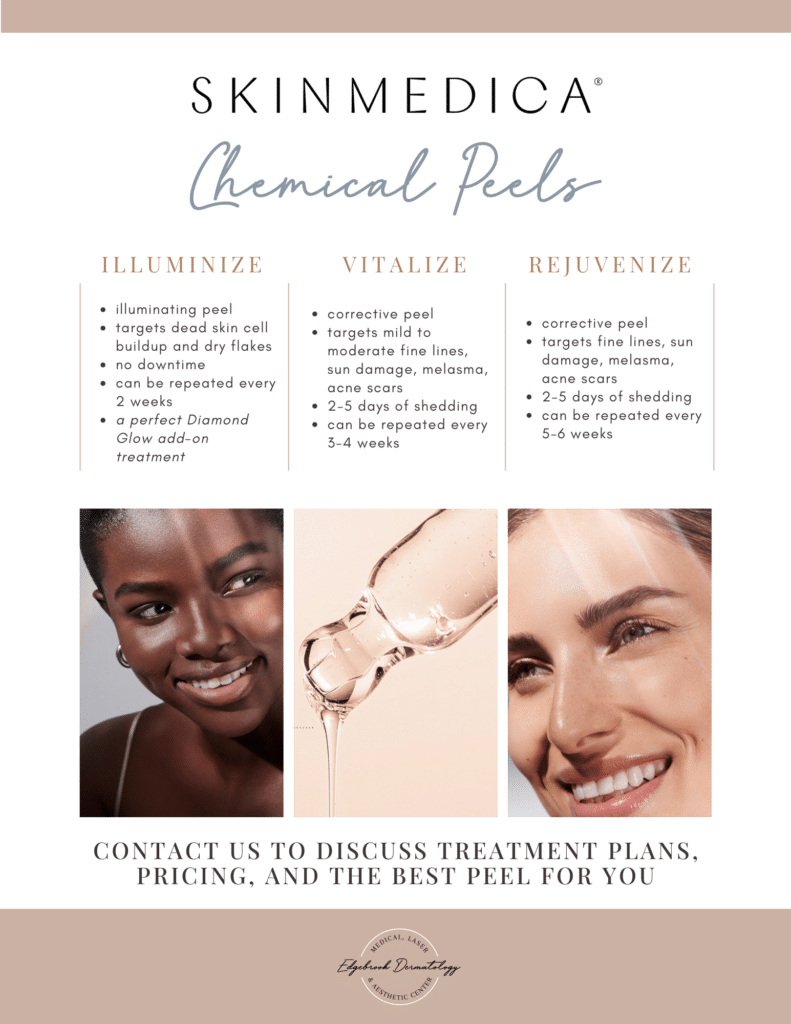 Chemical Peels - Edgebrook Dermatology