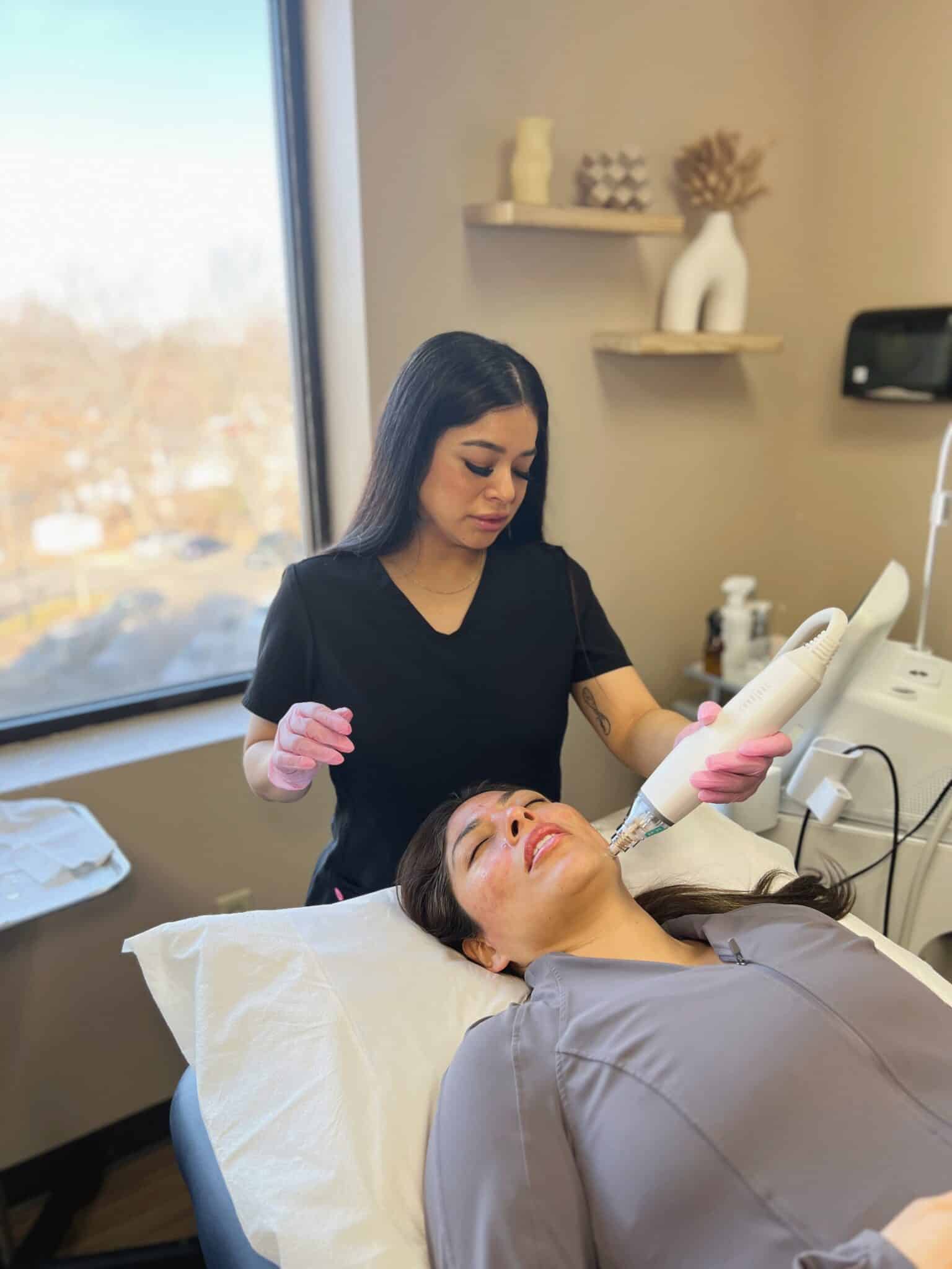 Potenza Microneedling (RF) | edgebrookdermatology